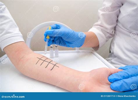 Immunologist Doing Skin Allergy Test Stock Image Image Of Clinical