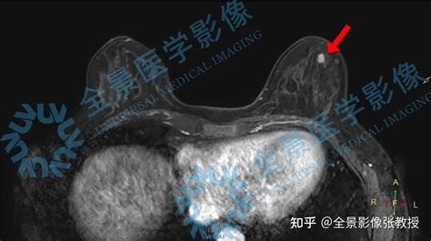 乳腺分泌：正确的时间叫乳汁，错误的时间叫溢液，为什么会出现这种情况？ 知乎