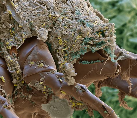 Moss Mite Sem Stock Image C057 4145 Science Photo Library
