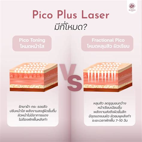 บอกลาสว อยากผวใส ให Pico Plus Laser เลเซอรรอยสว เปนตวชวย