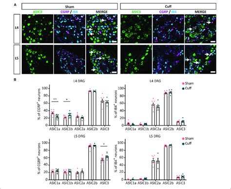quantitative analysis of the expression of asic subunits after nerve
