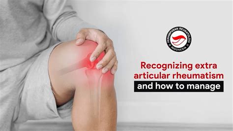 Recognizing Extra Articular Rheumatism And How To Manage Cme Reumatologi