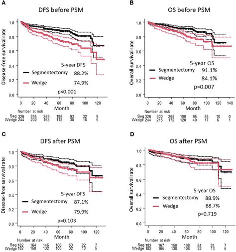 Frontiers Wedge Resection Vs Segmentectomy For Lung Cancer Measuring ≤ 2 Cm With