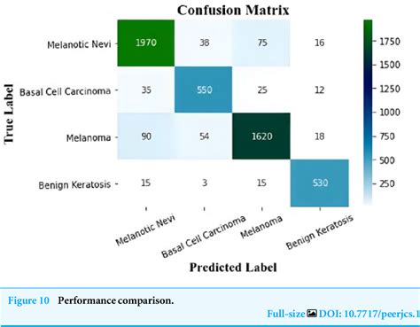 Figure 10 From Mscdnet Based Multi Class Classification Of Skin Cancer