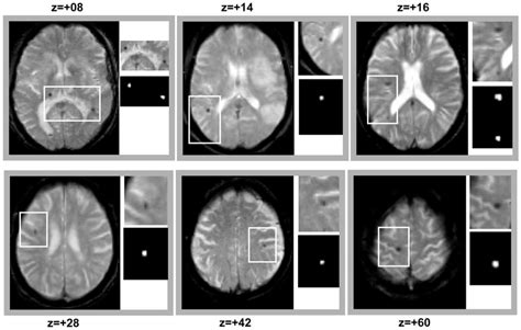 Midas Detection In 6 Different Patients With Variable Numbers And Download Scientific Diagram