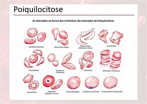 Hemácias Eritrócitos Conheça Suas Principais Funções E Alterações Ibap Cursos