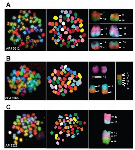 Apj Lymphomas Harbor Complex Variant Chromosomal Translocations