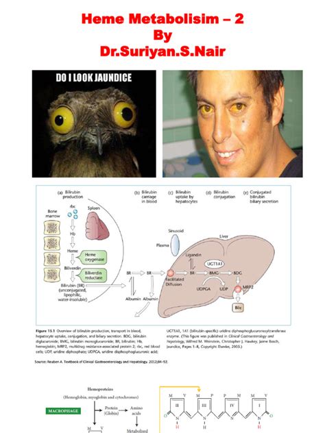 Jaundice Mbbs 2024 Pdf Liver Cell Biology