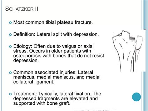 Proximal Tibia Fracture Pptx