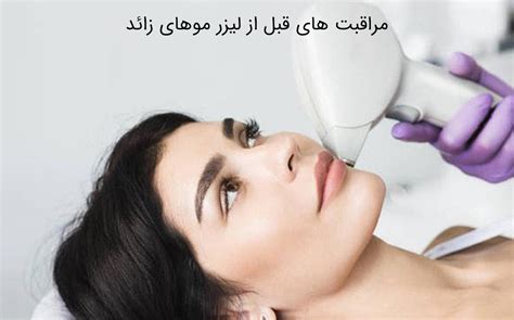 مراقبت های قبل و بعد از لیزر موهای زائد نکات آماده سازی برای لیزر