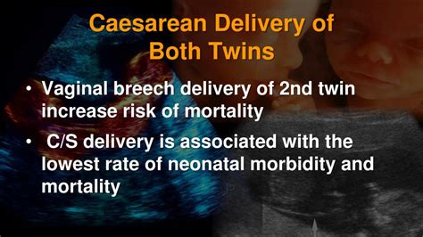 Ppt Delivering Twins Perils And Pitfalls Powerpoint Presentation Id 3025525
