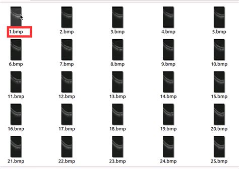 您好关于您代码中有一些问题想请教您 Issue ShawnBIT AI Challenger Retinal Edema Segmentation GitHub