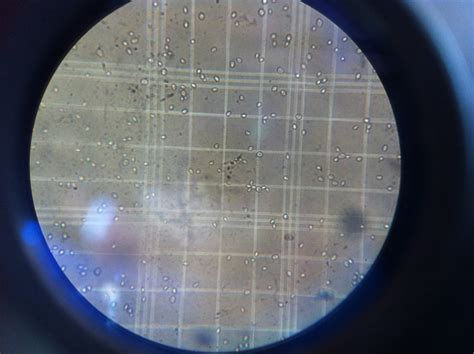 Cell Counting Microscope At Scott Cahill Blog