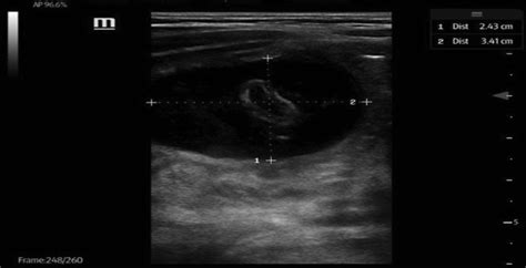 Pediatric Emergency Care