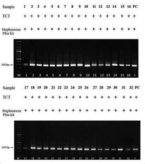 Staphylococcus Aureus Identification By Using Tube Coagulase Test Download Scientific Diagram