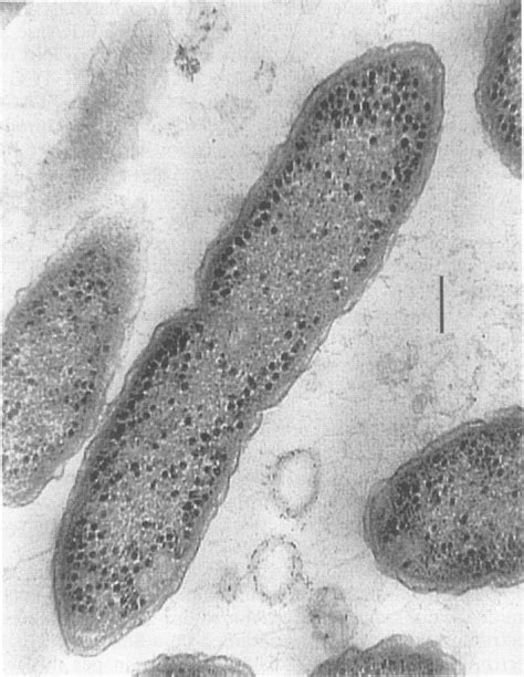 Growth Of Pca In Basal Medium With Acetate As An Electron Donor And