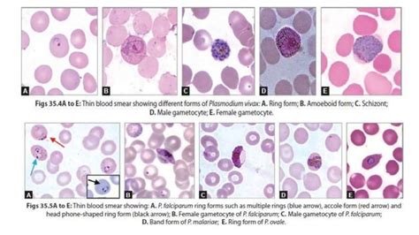 Malaria Lab Diagnosis Pptx