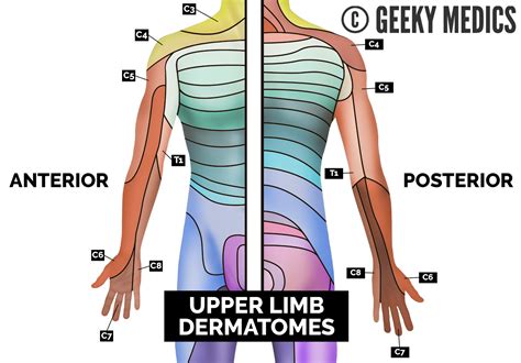 Dermatomes And Myotomes Sensation Anatomy Geeky Medics