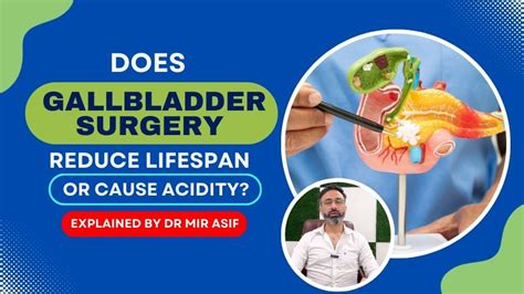 Does Gallbladder Surgery Reduce Life Span Or Cause Acidity