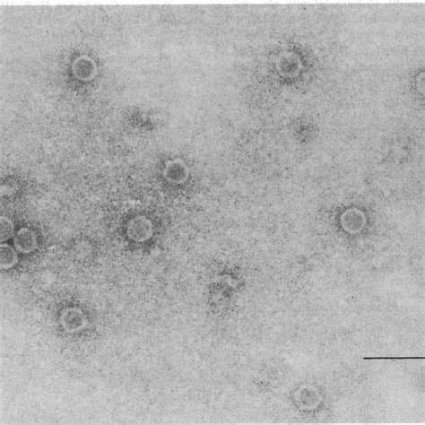 Cscl Buoyant Density Gradient Centrifugation Analysis Of The S2 And S3