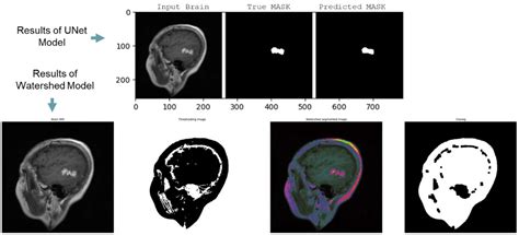 Github Engineer Ayesha Shafiquebrain Tumor Segmentation And
