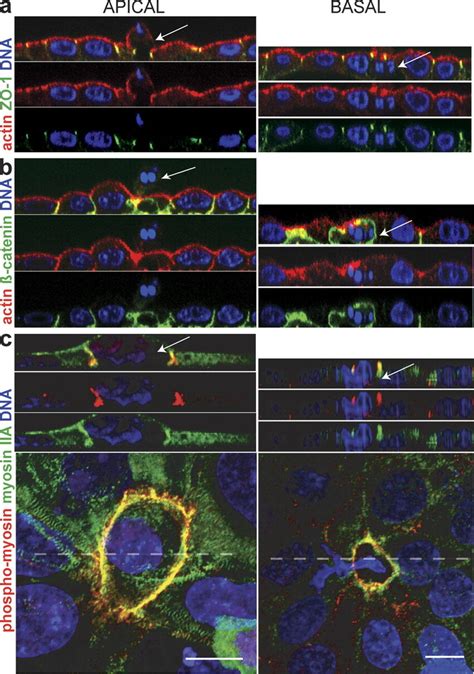 Localization Of Active Myosin Iia But Not Intrinsic Polarity Markers
