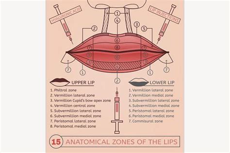 Lips Injections Image Artofit