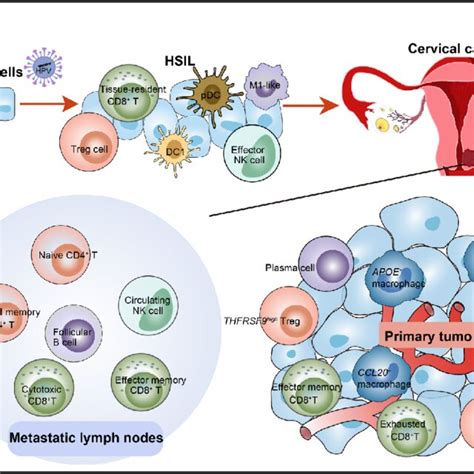 Evolution Of The Tumor Ecosystem During Cervical Cancer Initiation And Download Scientific