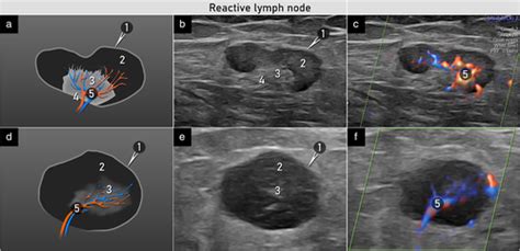 Terms Definitions And Measurements To Describe Sonographic Features Of