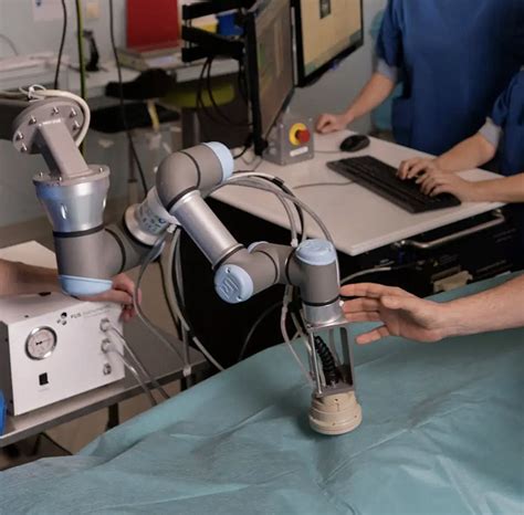 First In Man Results To Show Promise For Robot Assisted Hifu In Pad Treatment