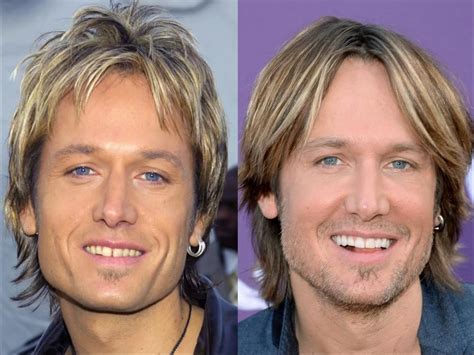 Teeth Keith Urban Celebrity Surgery Keith Urban Celebrities