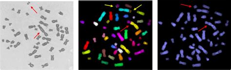 Dicentric Equivalent Scoring A 1st Division Giemsa Stained Metaphase Download Scientific
