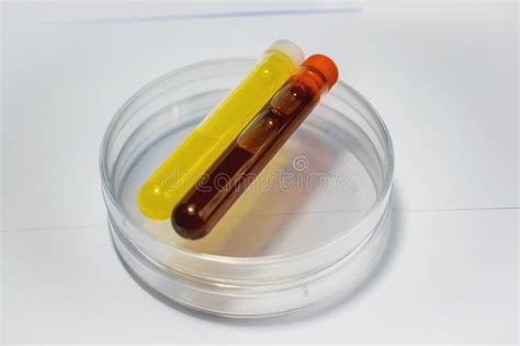 五颜六色的实验室试验管，生化验血，尿检，试管，医疗分析，研究概念，生育力r 库存图片 图片 包括有 例证 列表 110452321