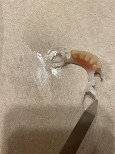 fix r dentures