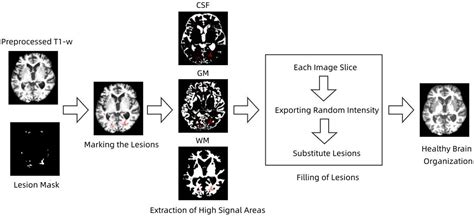 Energy Minimization Segmentation Model Based On Mri Images Cn1699 Social
