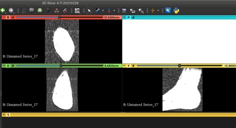 Blurry Image When Uploading Dicom Files Into Slicer Support 3d Slicer Community