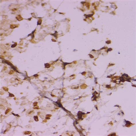Cancer Cell Detection Bounding Instance Segmentation Model By Gp