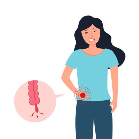 210 Appendicitis Surgery Stock Illustrations Royalty Free Vector