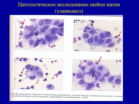 Значение, задачи и место метода клинической цитологии в медицине ...