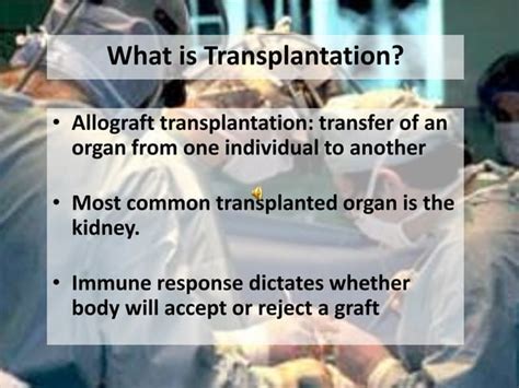 Organ Transplantation And The Hla System Lecture Pptx Genetics Science