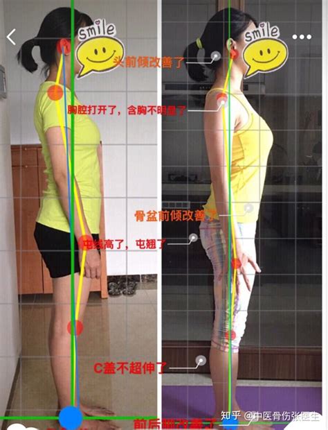 脖子后面鼓起来一个包 应该就是颈椎突出 知乎