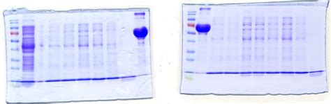 What Is The Reason For Lines In Separating Gel ResearchGate