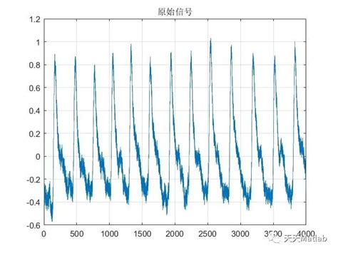 【信号去噪】基于小波变换实现脉搏信号去噪附matlab代码 智源社区