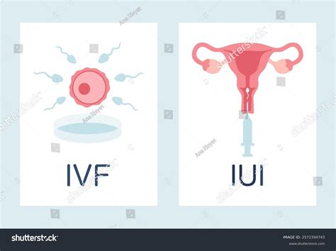 Vitro Fertilization Ivf Intrauterine Insemination Iui Stock Vector Royalty Free 2572394743