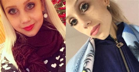 Mala 20 Kíl Nechuť K Jedlu Ale Aj K Sebe Keď Prehrala Boj S