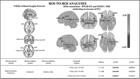 Exercise Modifies Hypothalamic Connectivity And Brain Functional Networks In Women After
