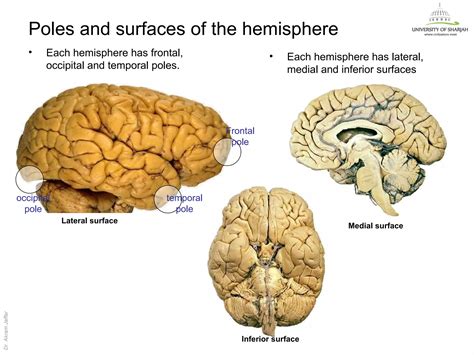 1 Ppt Brain And Nervous System Disorders Diseases And Conditions