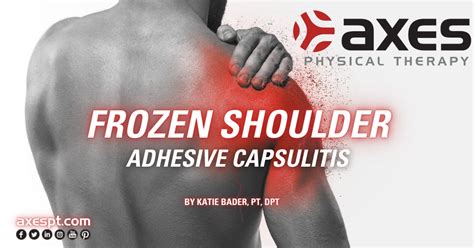 Frozen Shoulder Adhesive Capsulitis Axes Pt Blog
