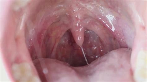 My Sexy Wet Uvula Hd Trailer