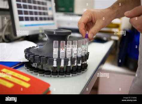 Abo Blood Type Testing Hi Res Stock Photography And Images Alamy
